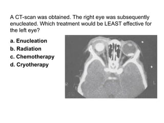 Ophthalmology quick Quiz - Retinoblastoma Riyad Banayot.ppt