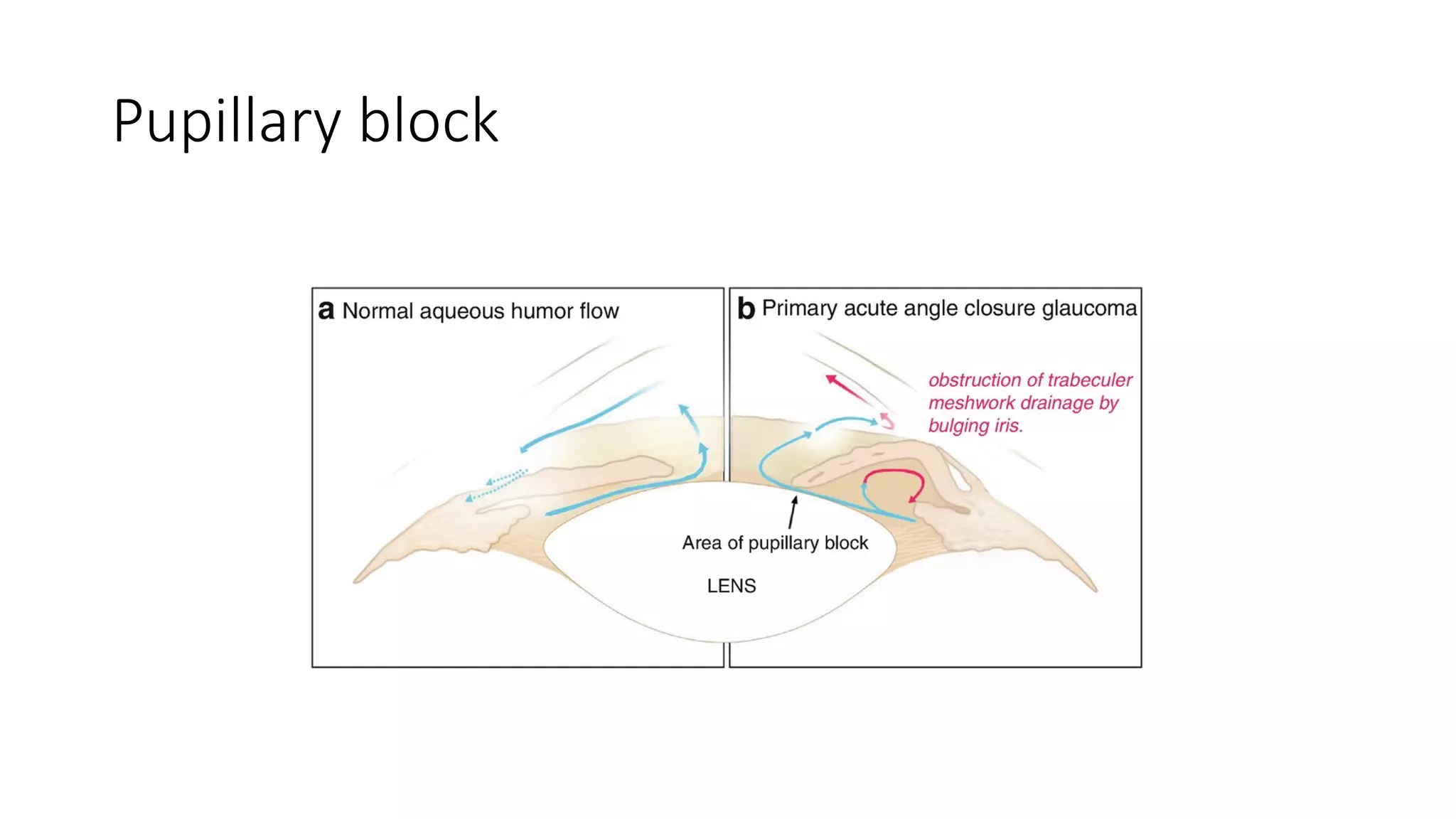 Ophthalmology revision for MD finals | PDF