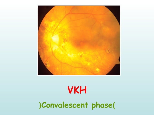 Ophthalmology Signs Around Us II ! | PPT