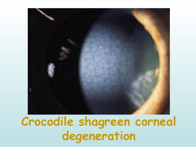 Ophthalmology Signs Around Us II