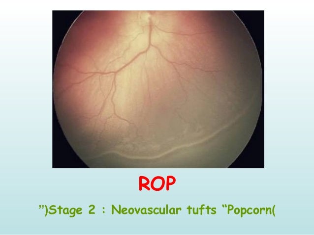 Ophthalmology Signs Around Us II