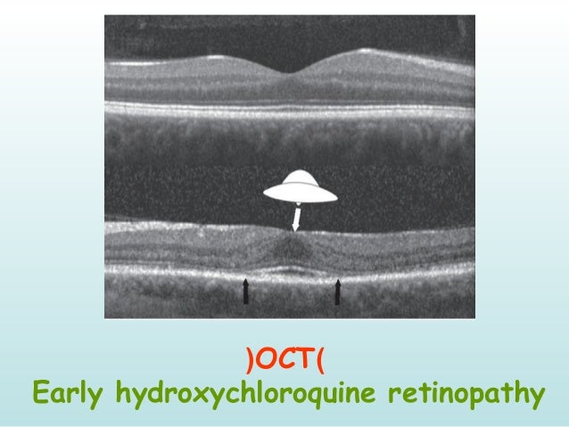 Ophthalmology Signs Around Us II