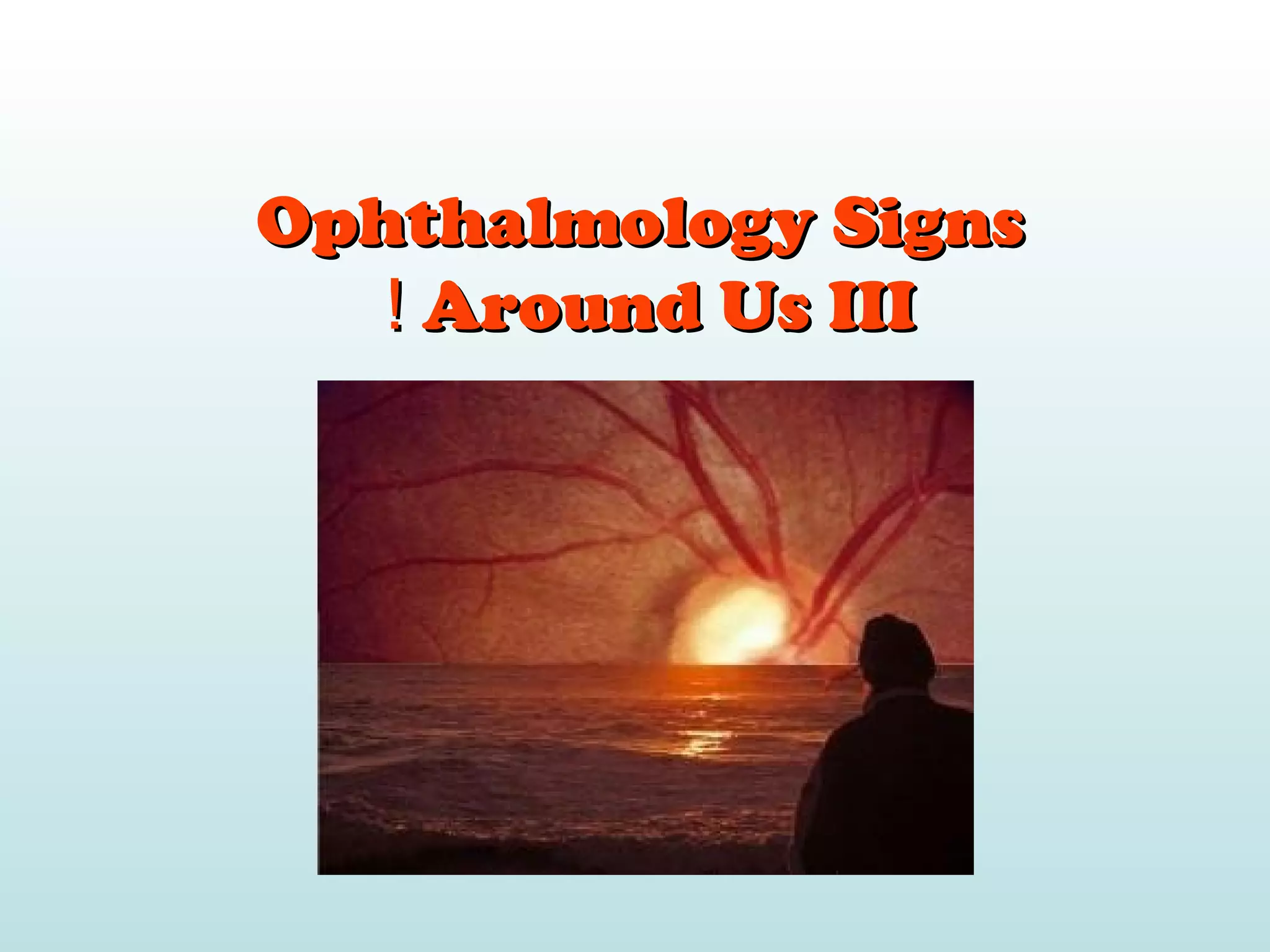 Ophthalmology Signs Around Us III ! | PPT