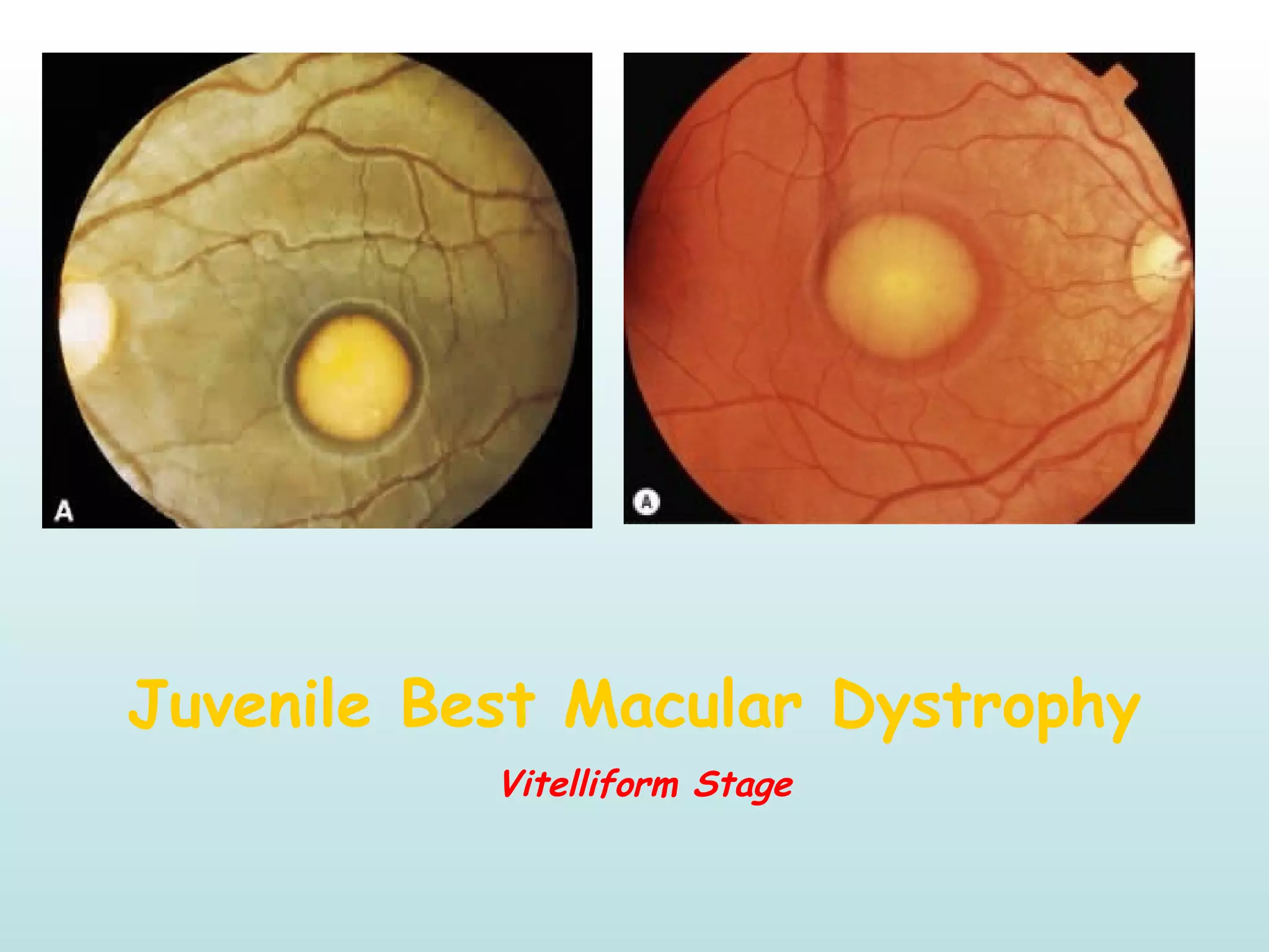 Ophthalmology Signs Around Us ! | PPS