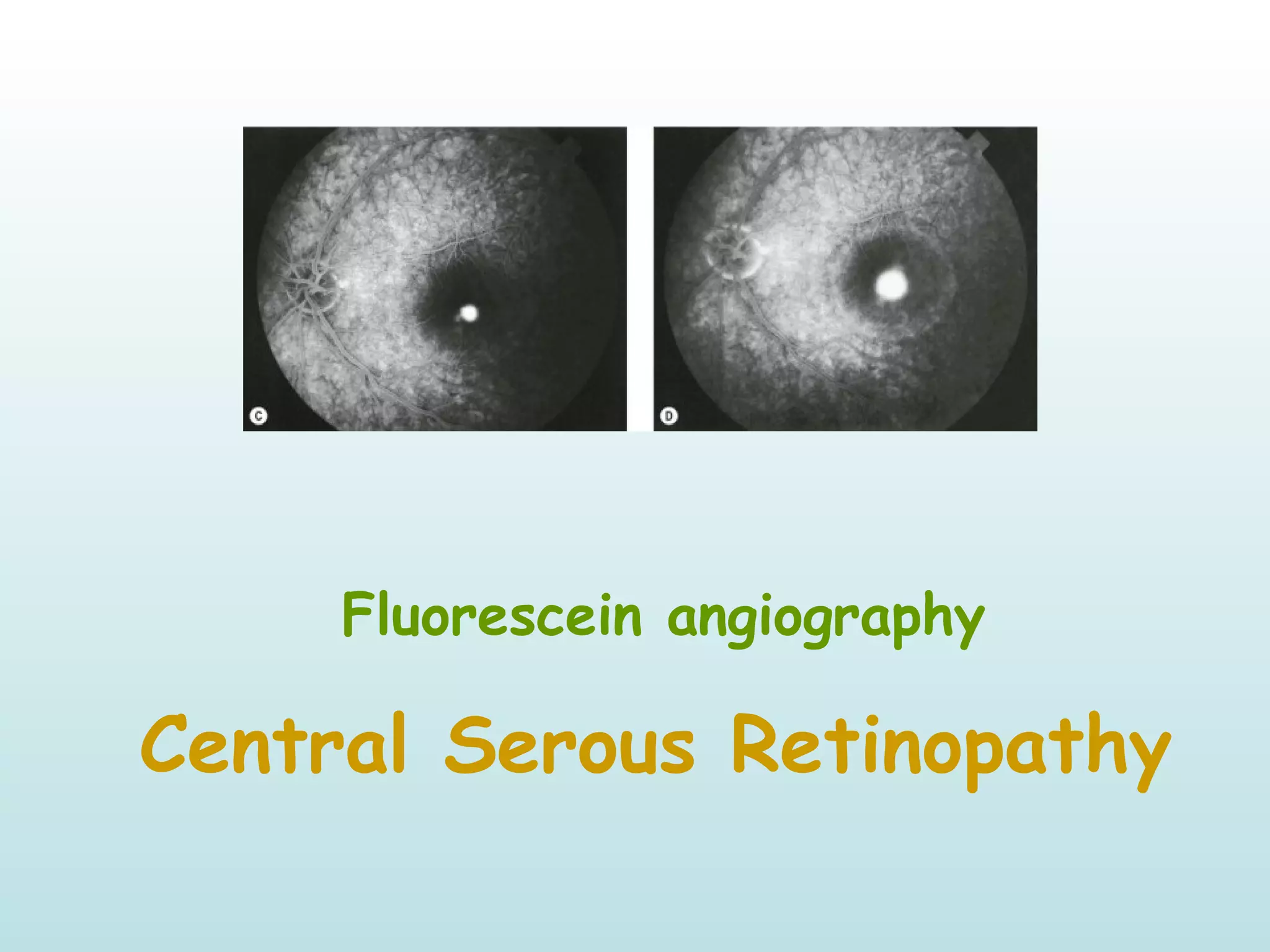 Ophthalmology Signs Around Us ! | PPS