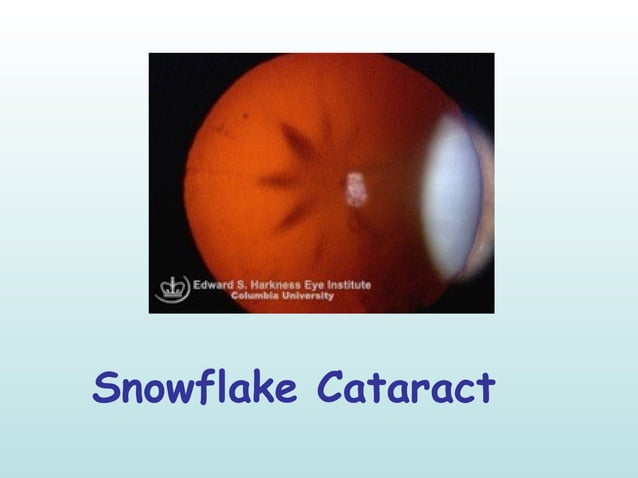 Ophthalmology Signs Around Us ! | PPT | Free Download