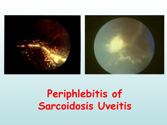 Ophthalmology Signs Around Us ! | PPT