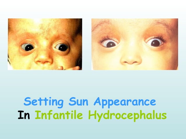 Ophthalmology Signs Around Us ! | PPT