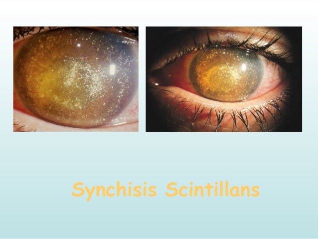 Ophthalmology Signs Around Us