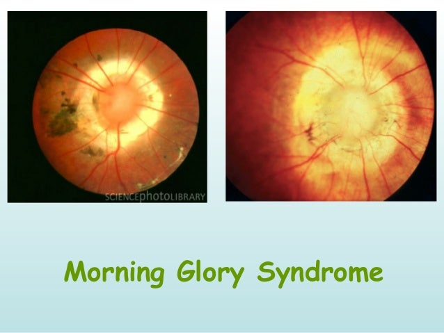 Ophthalmology Signs Around Us