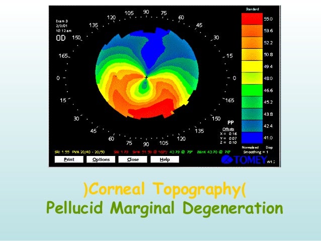 Ophthalmology Signs Around Us