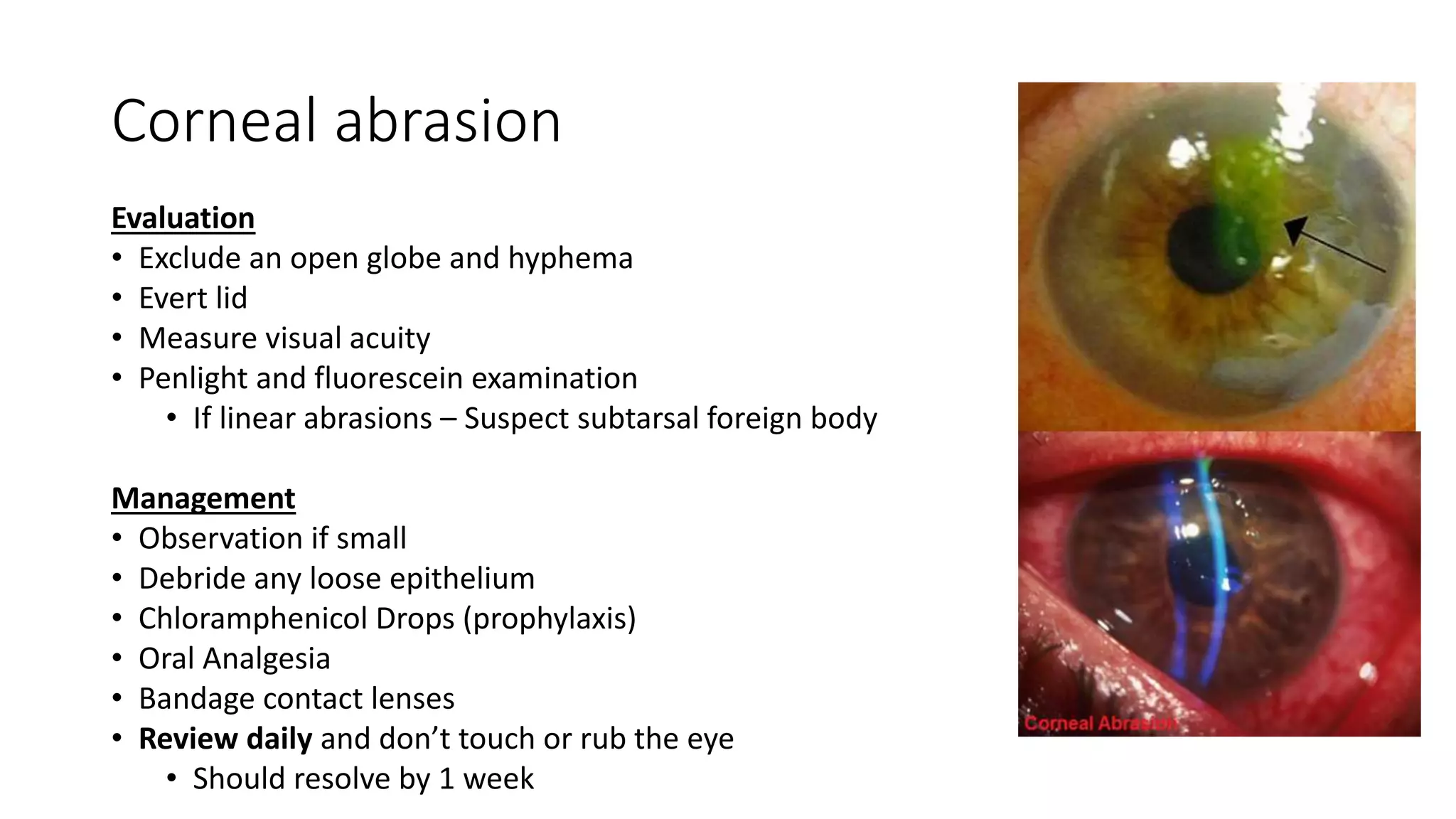 Ophthalmology lecture.pptx