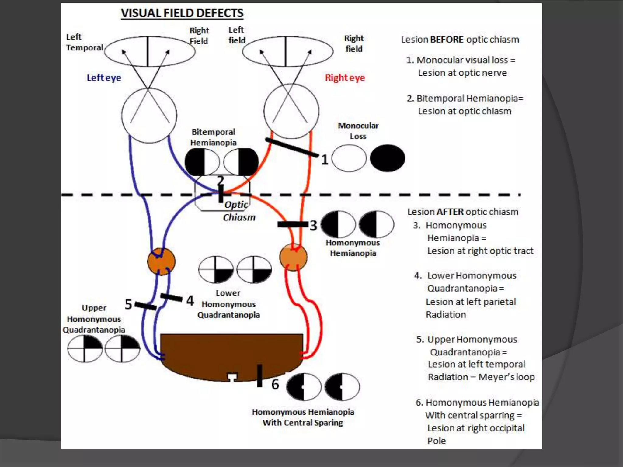 Visual Pathway - Ophthalmology - Eye | PPTX