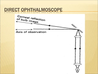 OPHTHALMOSCOPE Discreption in detail .ppt