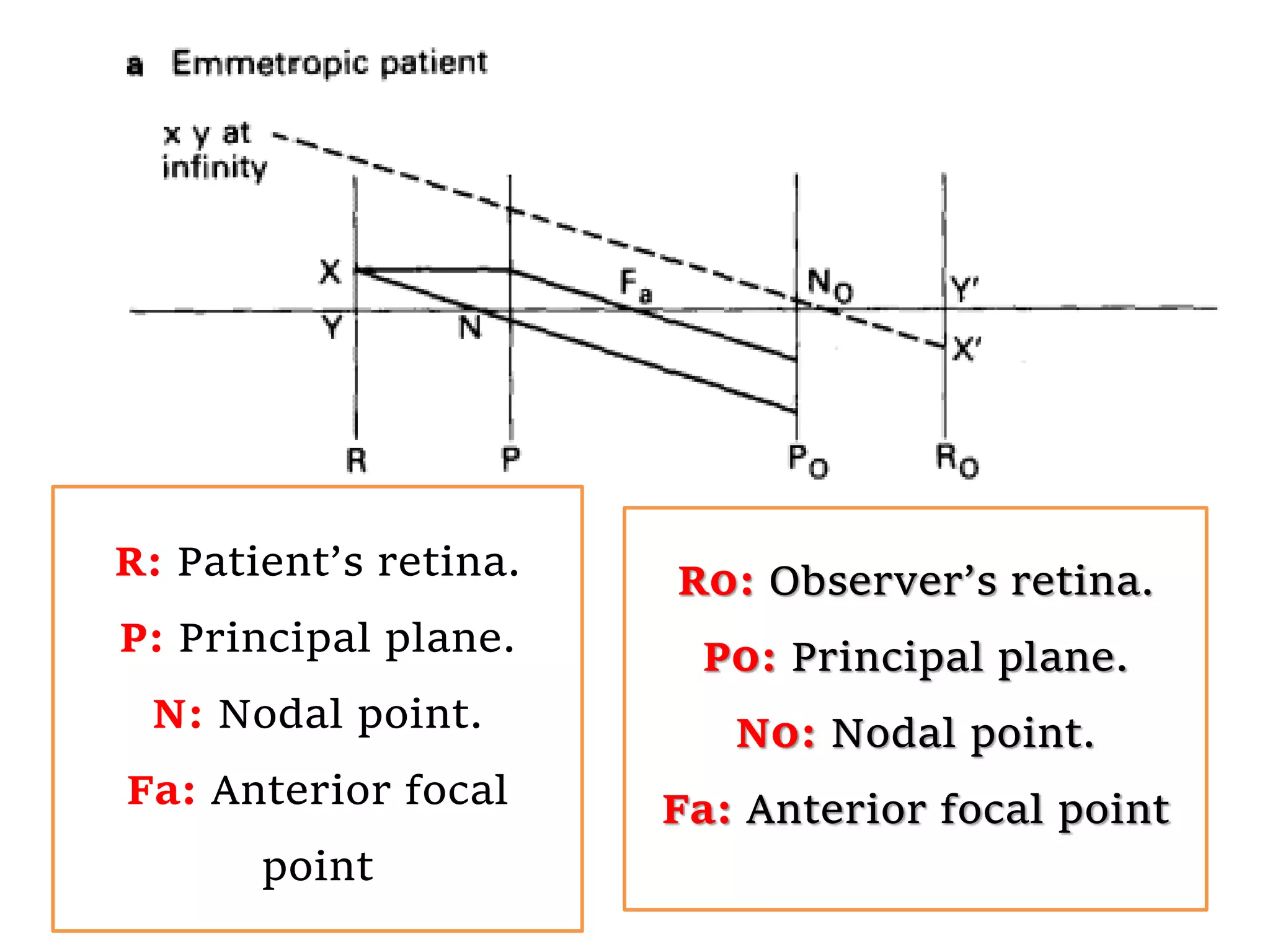 Ophthalmoscope direct and indirect | PPTX