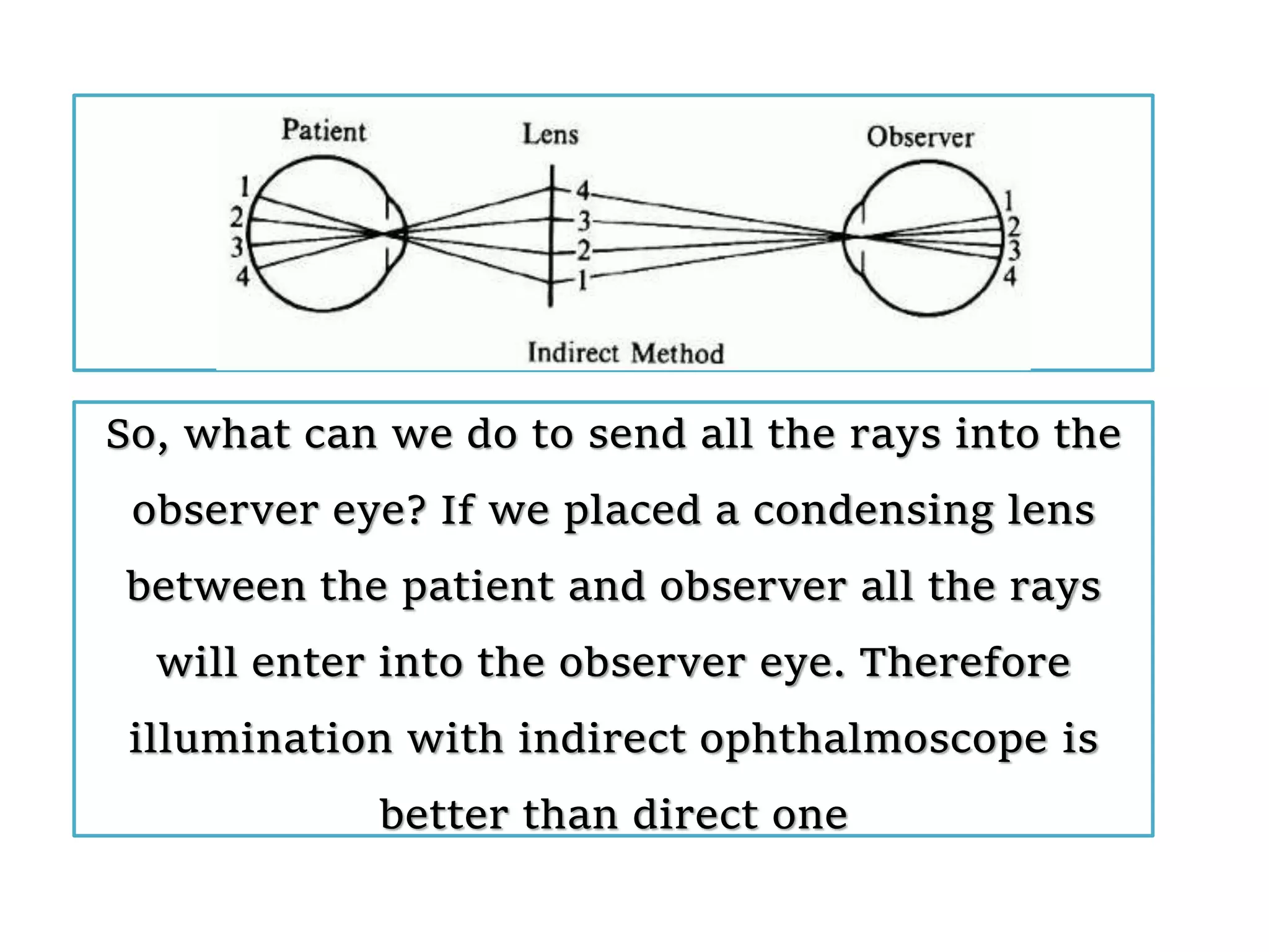 Ophthalmoscope direct and indirect | PPTX
