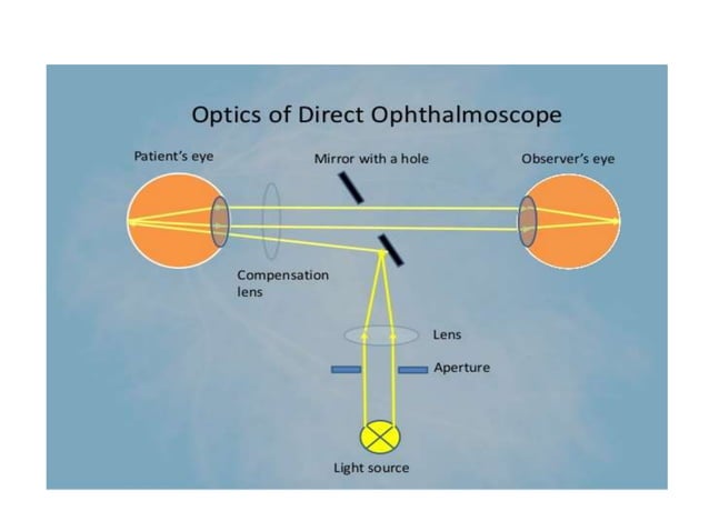 Ophthalmoscope direct and indirect | PPTX | Eye and Vision Conditions ...