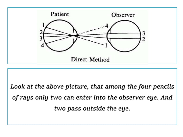 Ophthalmoscope direct and indirect | PPTX | Eye and Vision Conditions ...
