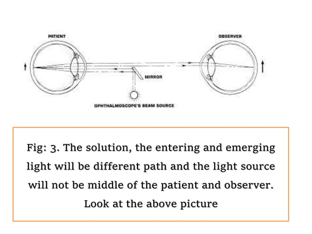 Ophthalmoscope direct and indirect | PPTX | Eye and Vision Conditions ...