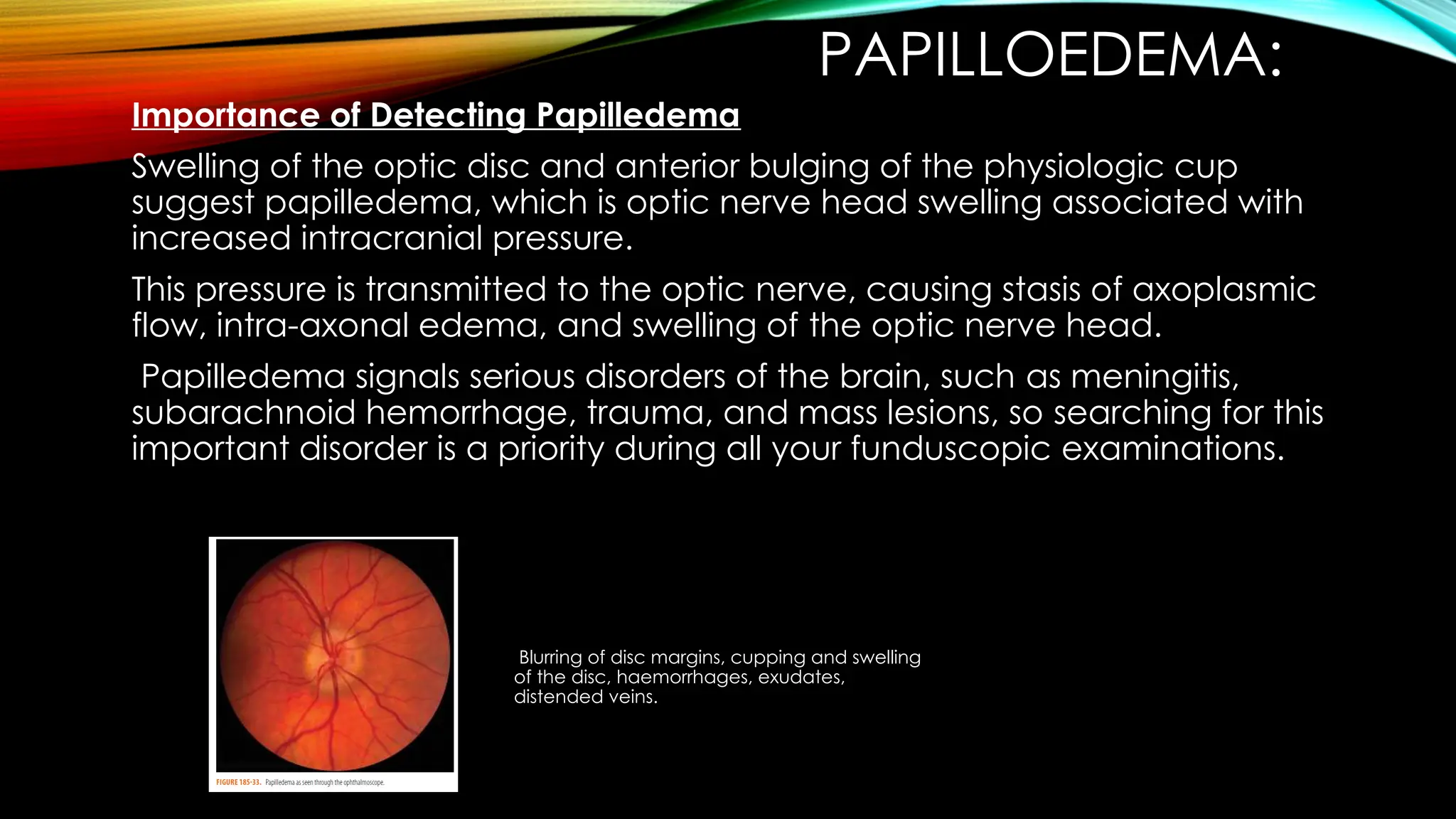 Ophthalmoscopic (Funduscopic) Examination.pptx