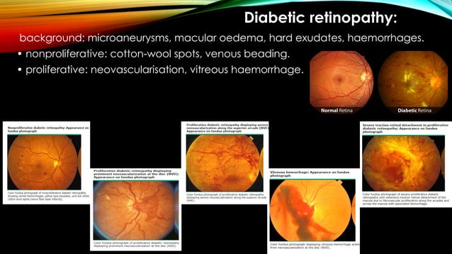 Ophthalmoscopic (Funduscopic) Examination.pptx
