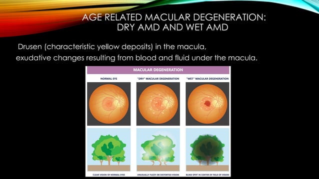 Ophthalmoscopic (Funduscopic) Examination.pptx