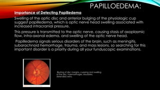 Ophthalmoscopic (Funduscopic) Examination.pptx