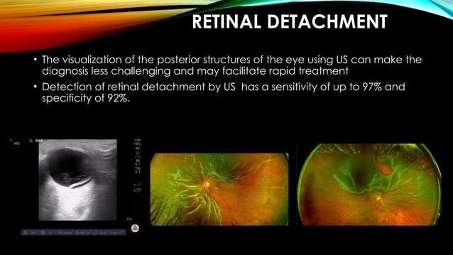 Ophthalmoscopic (Funduscopic) Examination.pptx