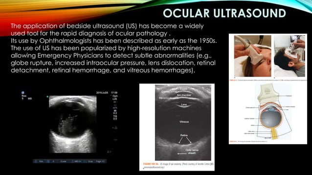 Ophthalmoscopic (Funduscopic) Examination.pptx