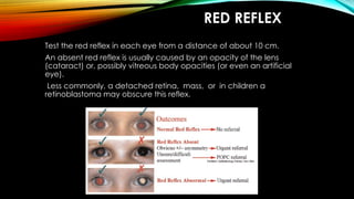 Ophthalmoscopic (Funduscopic) Examination.pptx
