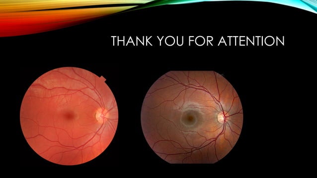 Ophthalmoscopic (Funduscopic) Examination.pptx