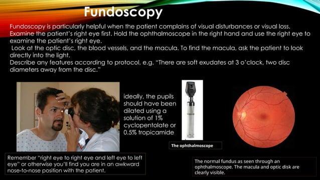 Ophthalmoscopic (Funduscopic) Examination.pptx