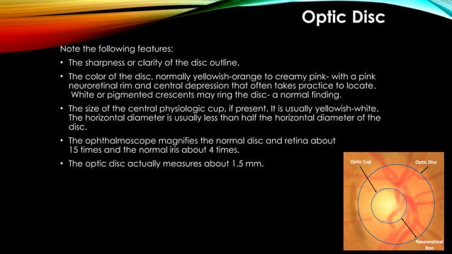 Ophthalmoscopic (Funduscopic) Examination.pptx