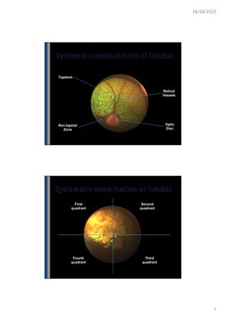 Ophthalmoscopy | PDF