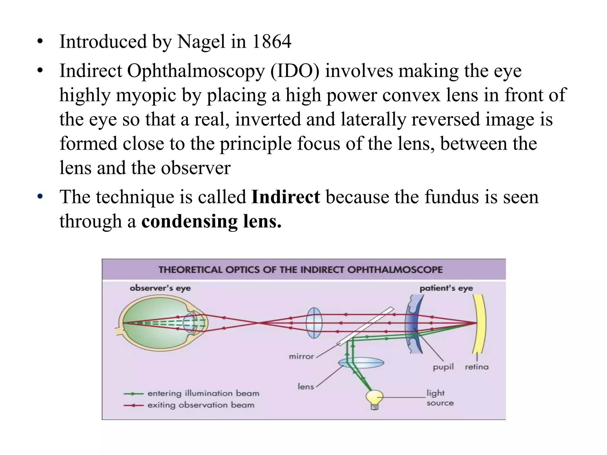 Ophthalmoscopy | PPTX