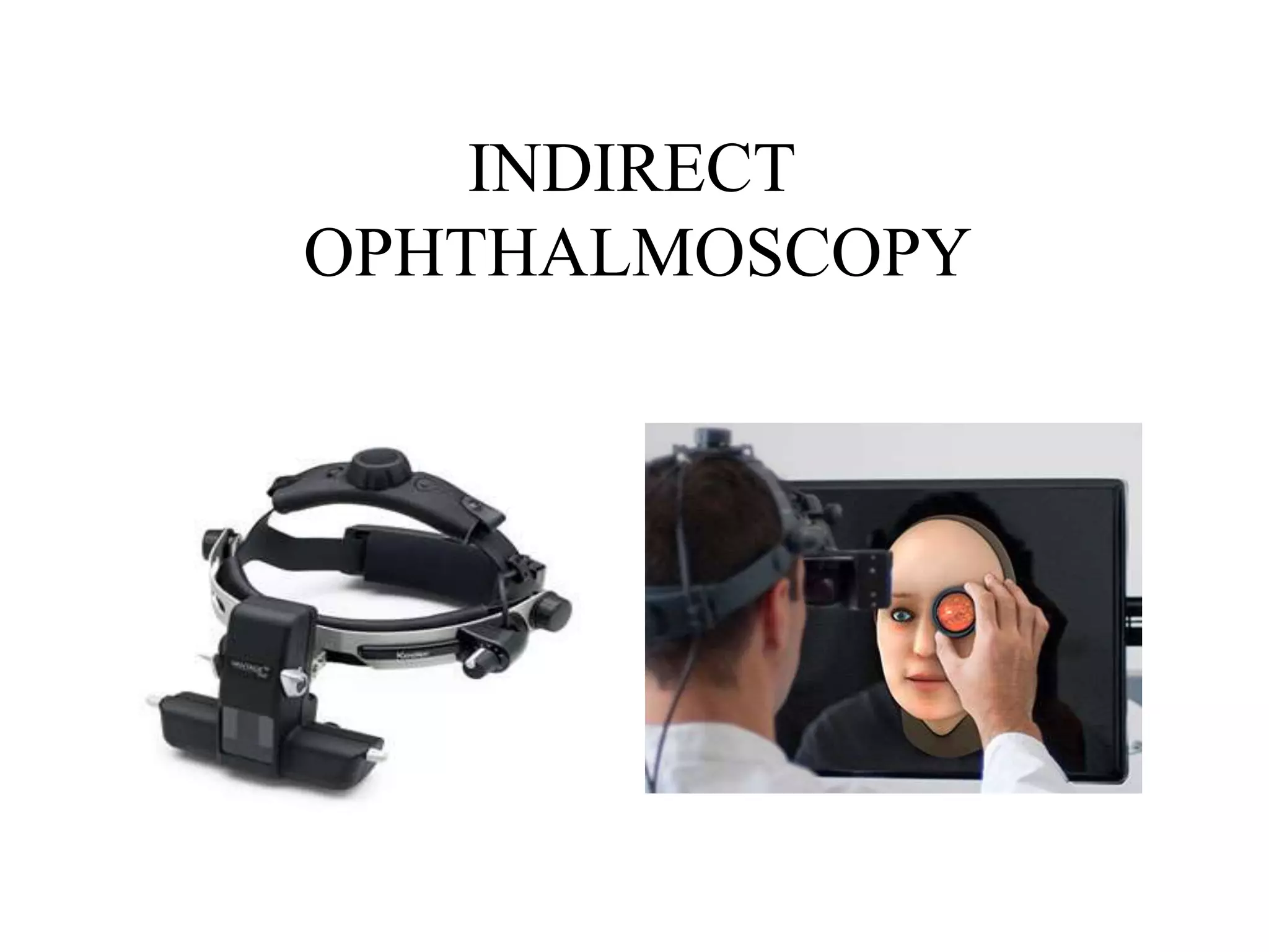 Ophthalmoscopy | PPTX