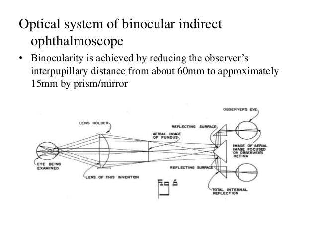 Ophthalmoscopy