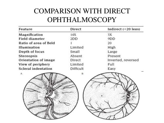 Ophthalmoscopy