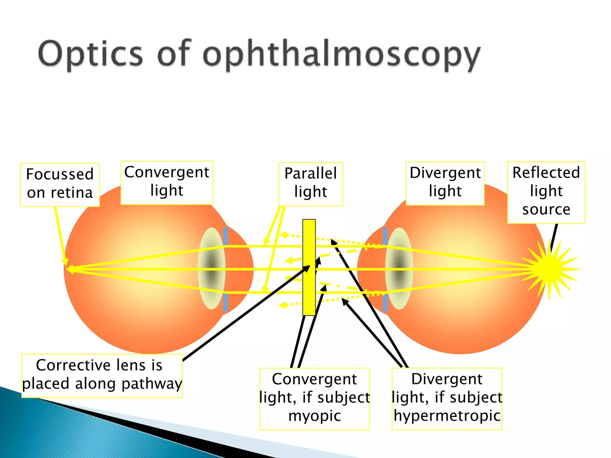 Ophthalmoscopy | PPTX