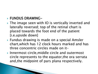 Ophthalmoscopy | PPTX