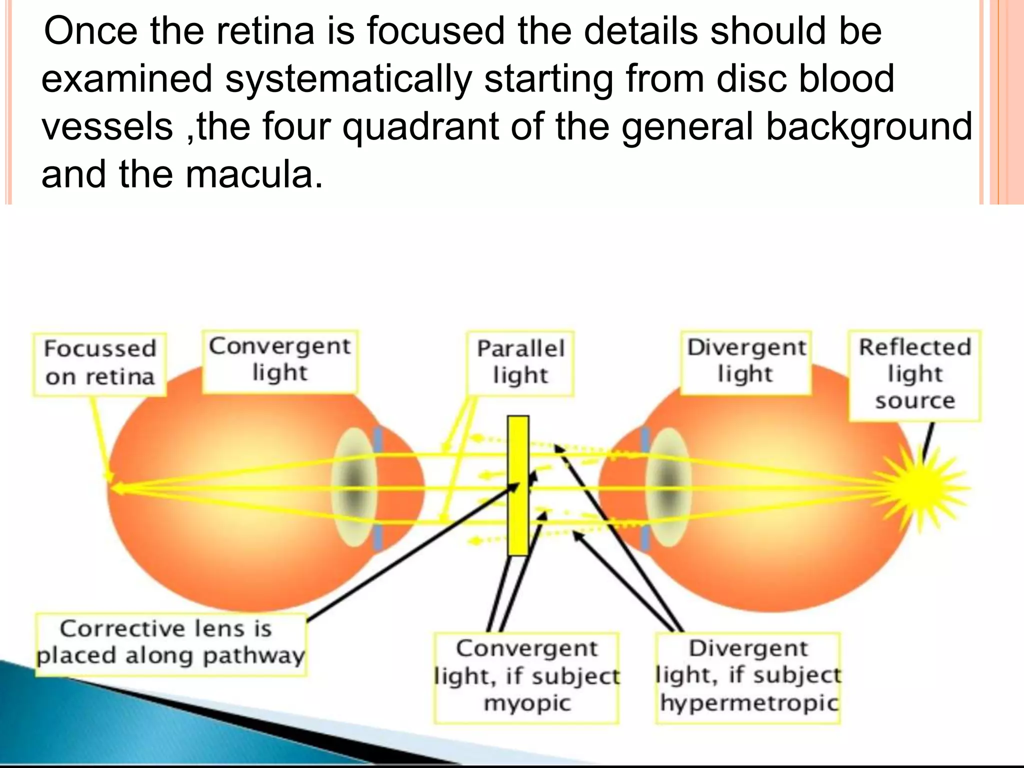 Ophthalmoscopy | PPTX
