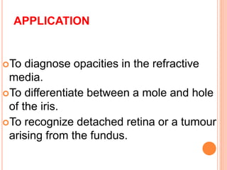 Ophthalmoscopy | PPTX