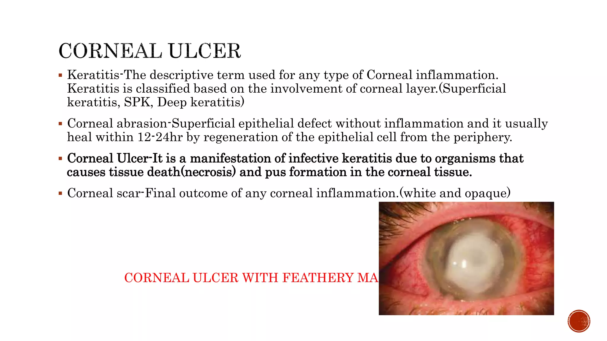 Corneal ulcer | PPTX