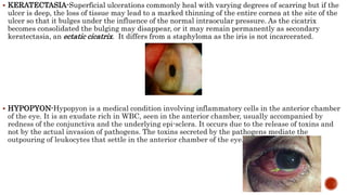 Corneal ulcer | PPTX