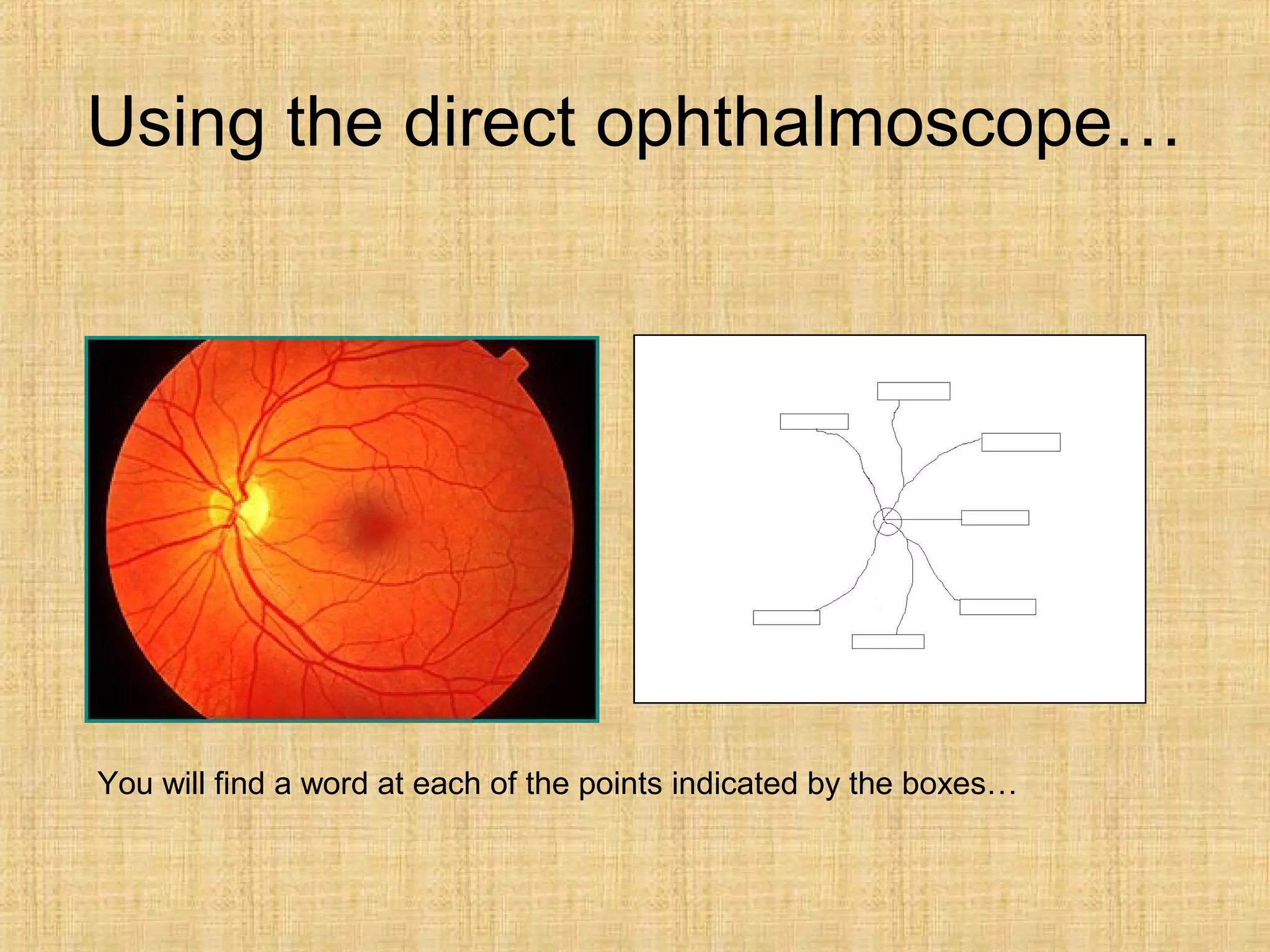 Ophthamology Revision | PPT