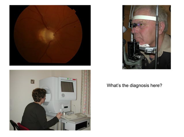 Ophthamology Revision | PPT
