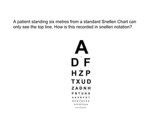 Ophthamology Revision | PPT