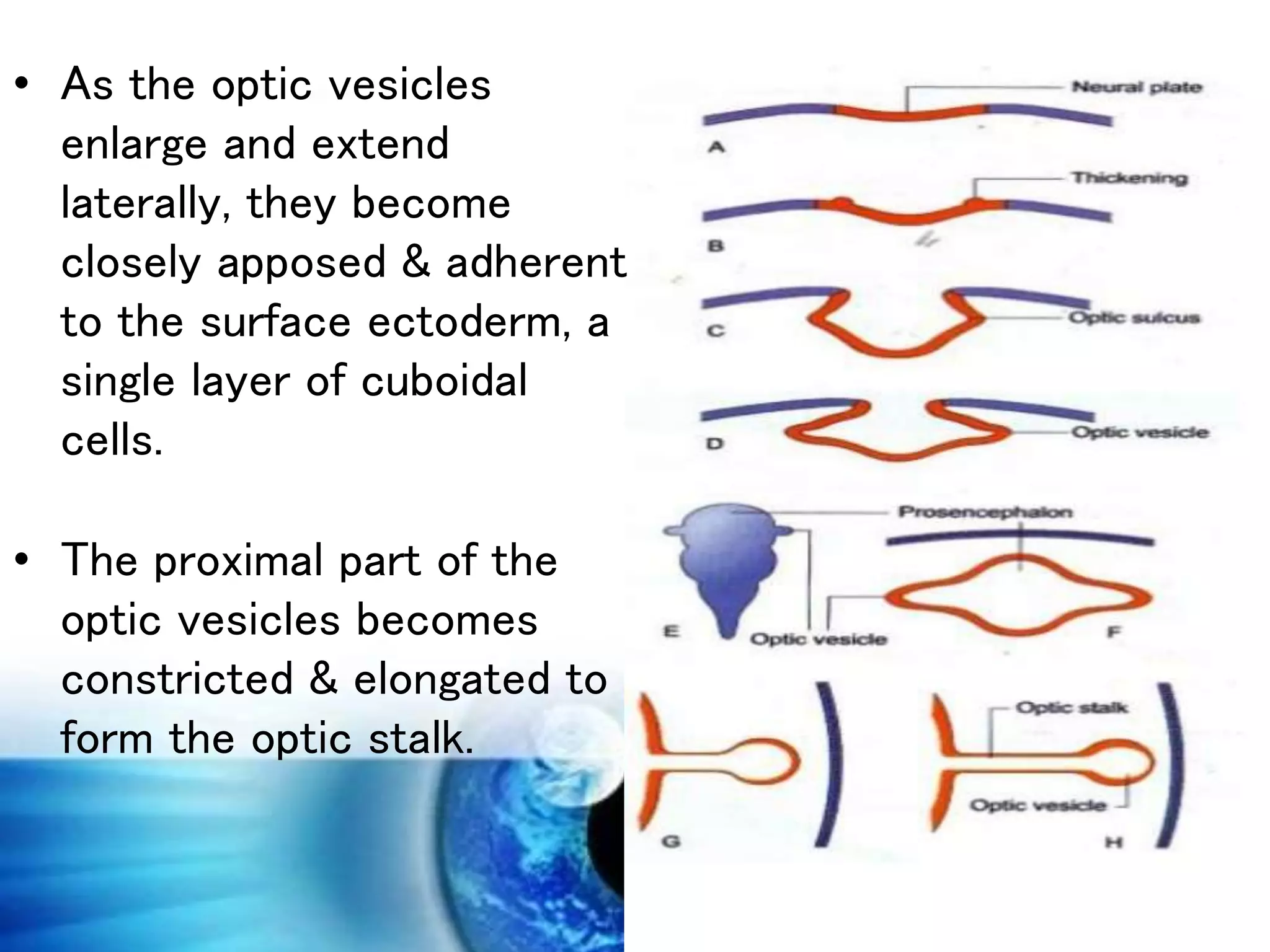Embryology and developmental defects of lens | PPTX