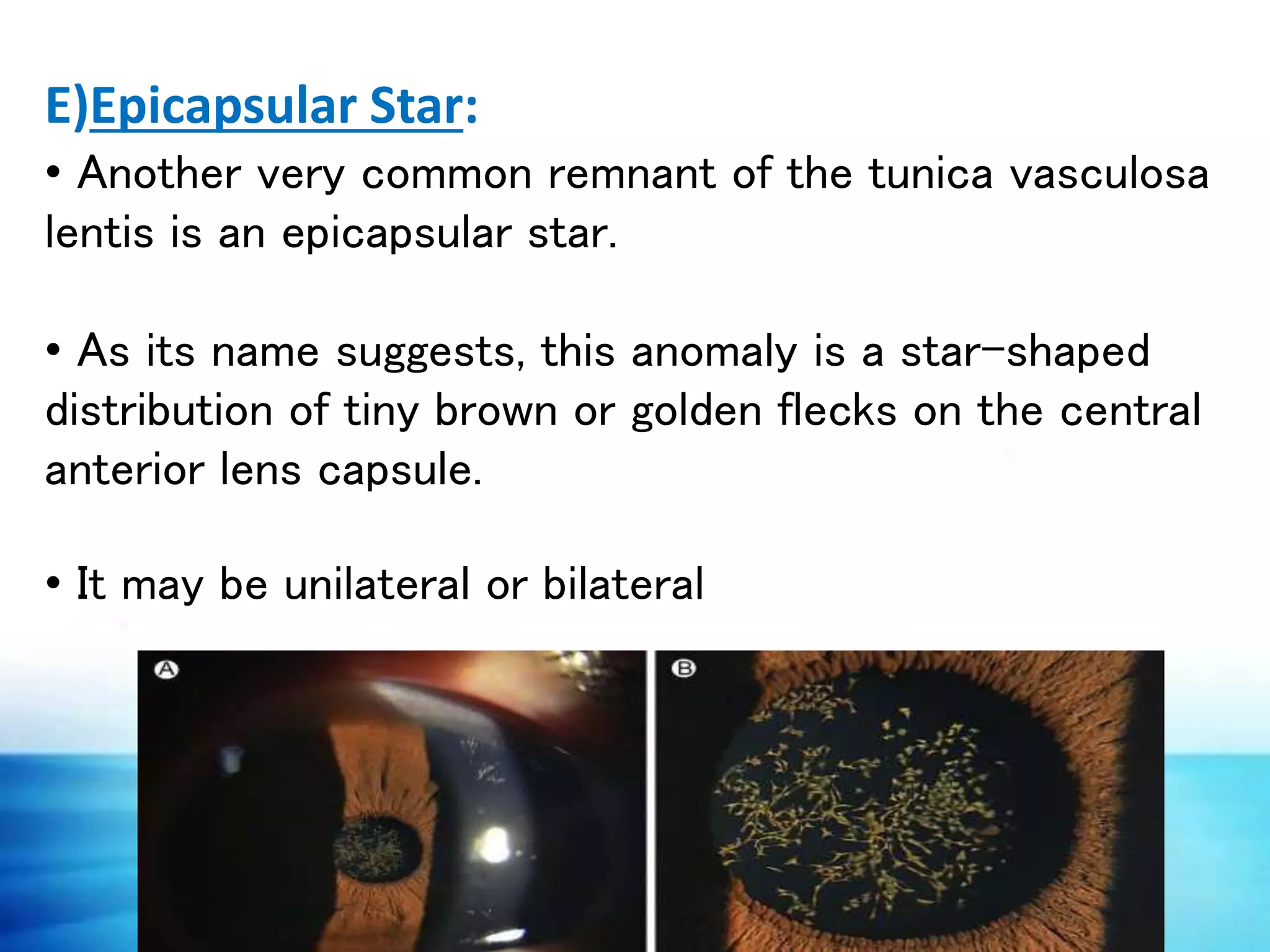 Embryology and developmental defects of lens | PPTX