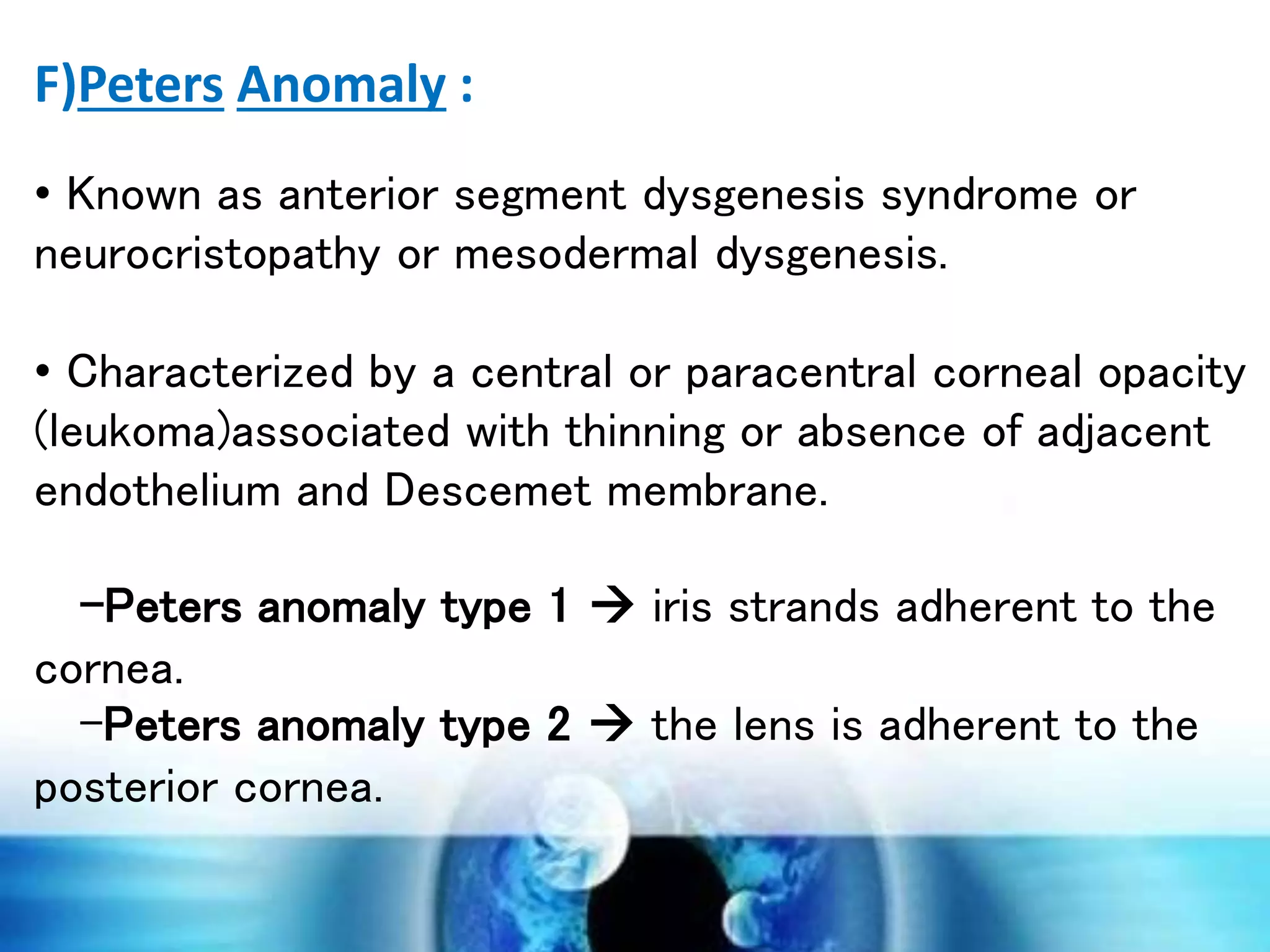 Embryology and developmental defects of lens | PPTX